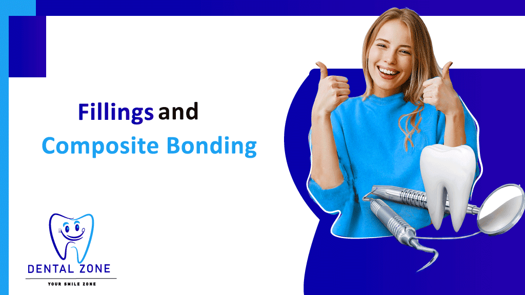 Fillings and Bonding | what to expect if you have your teeth bonded